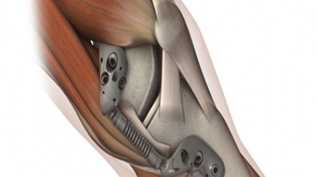 Vertex Ventures participates in Moximed $33m Series B round